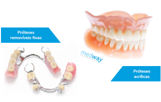Prótese Dentária | Fixa ou Removivel | Porto / Gaia